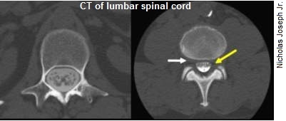 The nervous system and the identification and consequences of damage ...