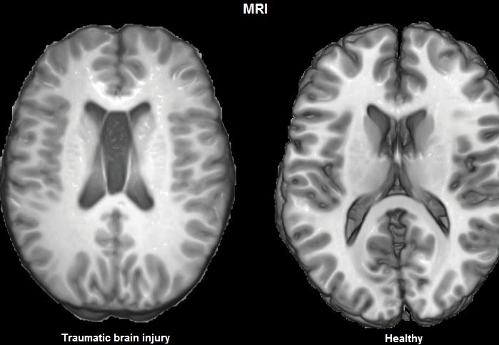 The nervous system and the identification and consequences of damage ...