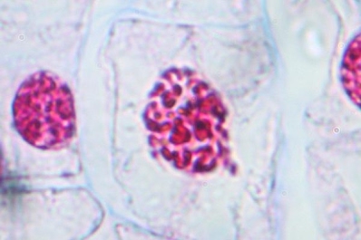 prophase | The A Level Biologist - Your Hub